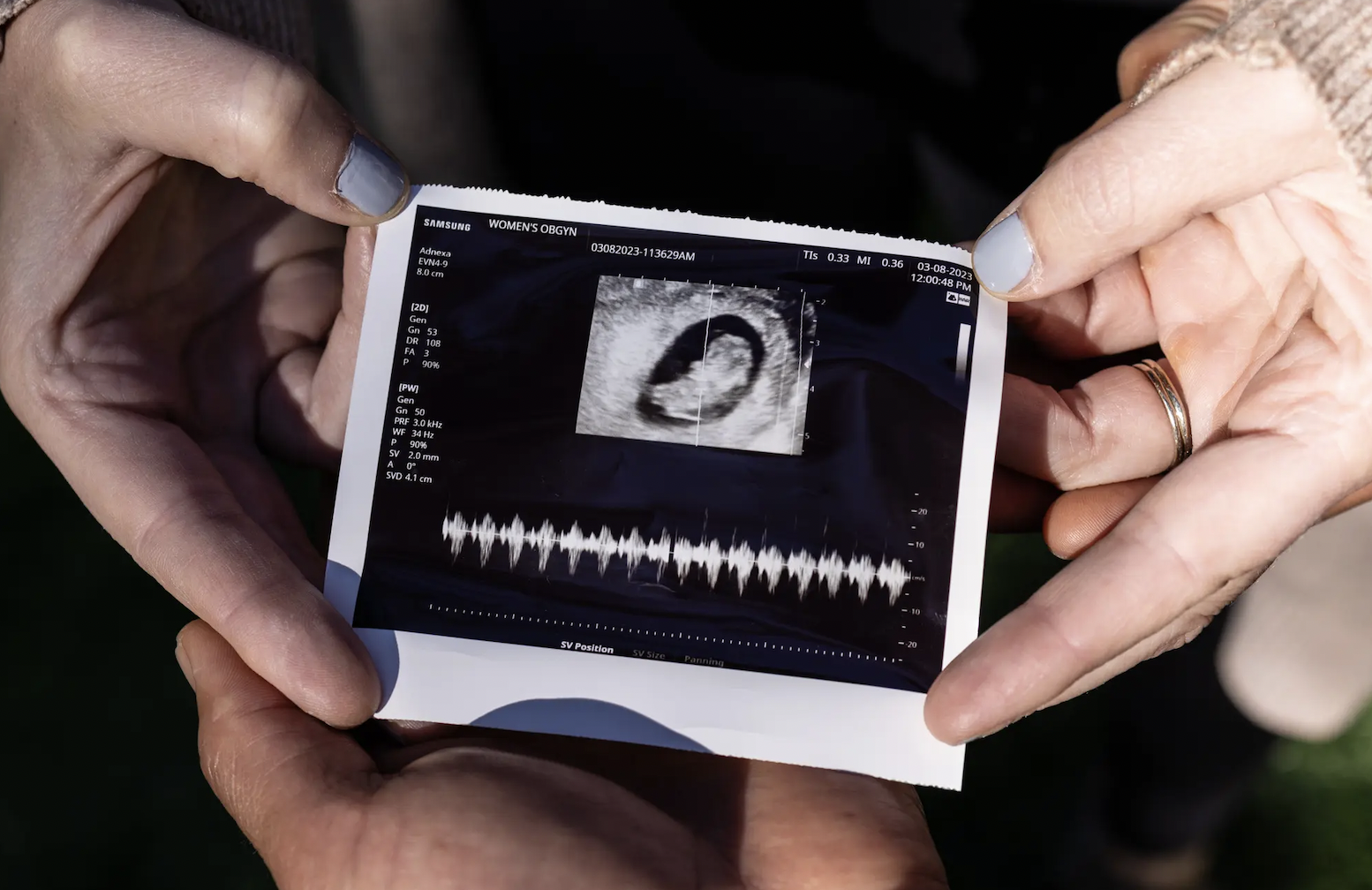 Articles – Erin Edwards